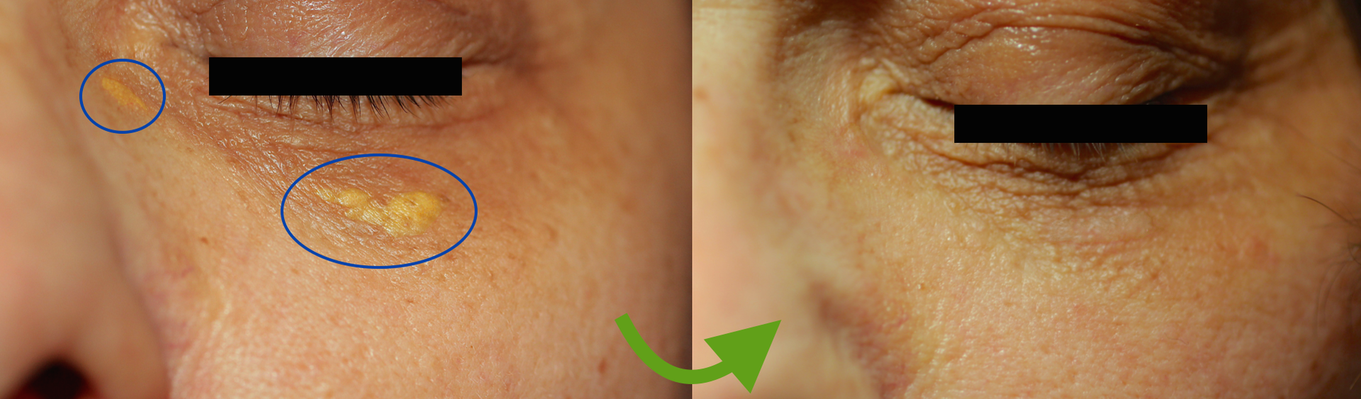 Dermatologia Laser - Laser Milano : Centro Clinico Via Milano